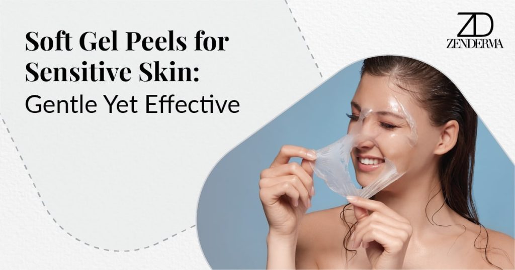 Soft Gel Peels for Sensitive Skin: Gentle Yet Effective | Zenderma